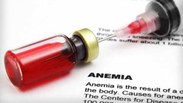 Novel Smartphone App Can Detect Anaemia Without Blood Test