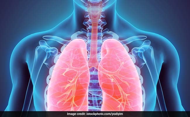 Fat Can Accumulate Inside Lungs Of Obese People And Increase Asthma ...