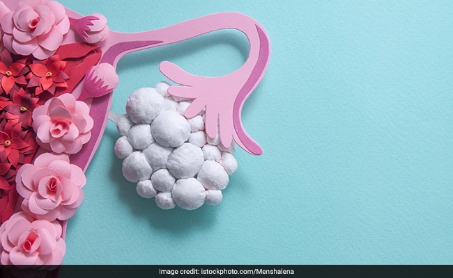 PCOS Awareness Month: Diet And Lifestyle Modifications To Manage ...