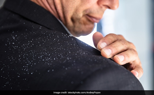 Haircare Tips: Get Rid Of Seasonal Dandruff With These Tips