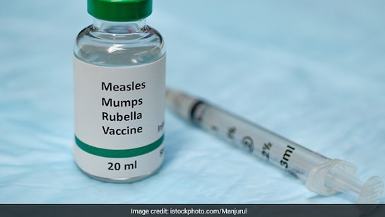 mumps outbreak texas