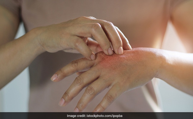 What Is Pollution Rash: Signs And Prevention Tips For Skin Rashes