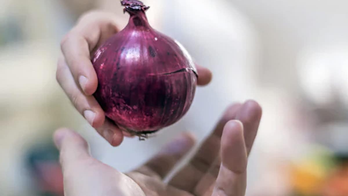 Grocery Guide: 5 Smart Ways To Avoid Buying Rotten Onions - NDTV Food