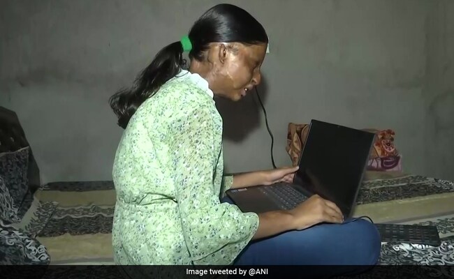 Acid Attack Survivor Scores 95% In CBSE Class 10 Exams, Tops School