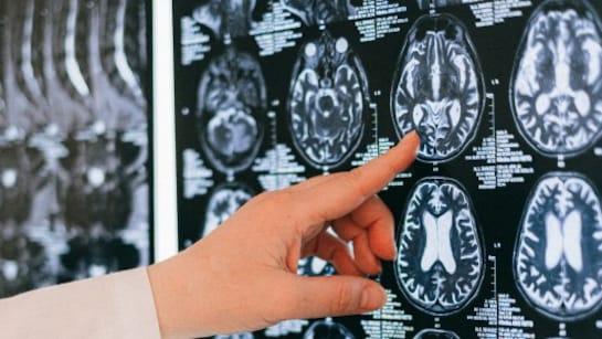 forgetting memory name