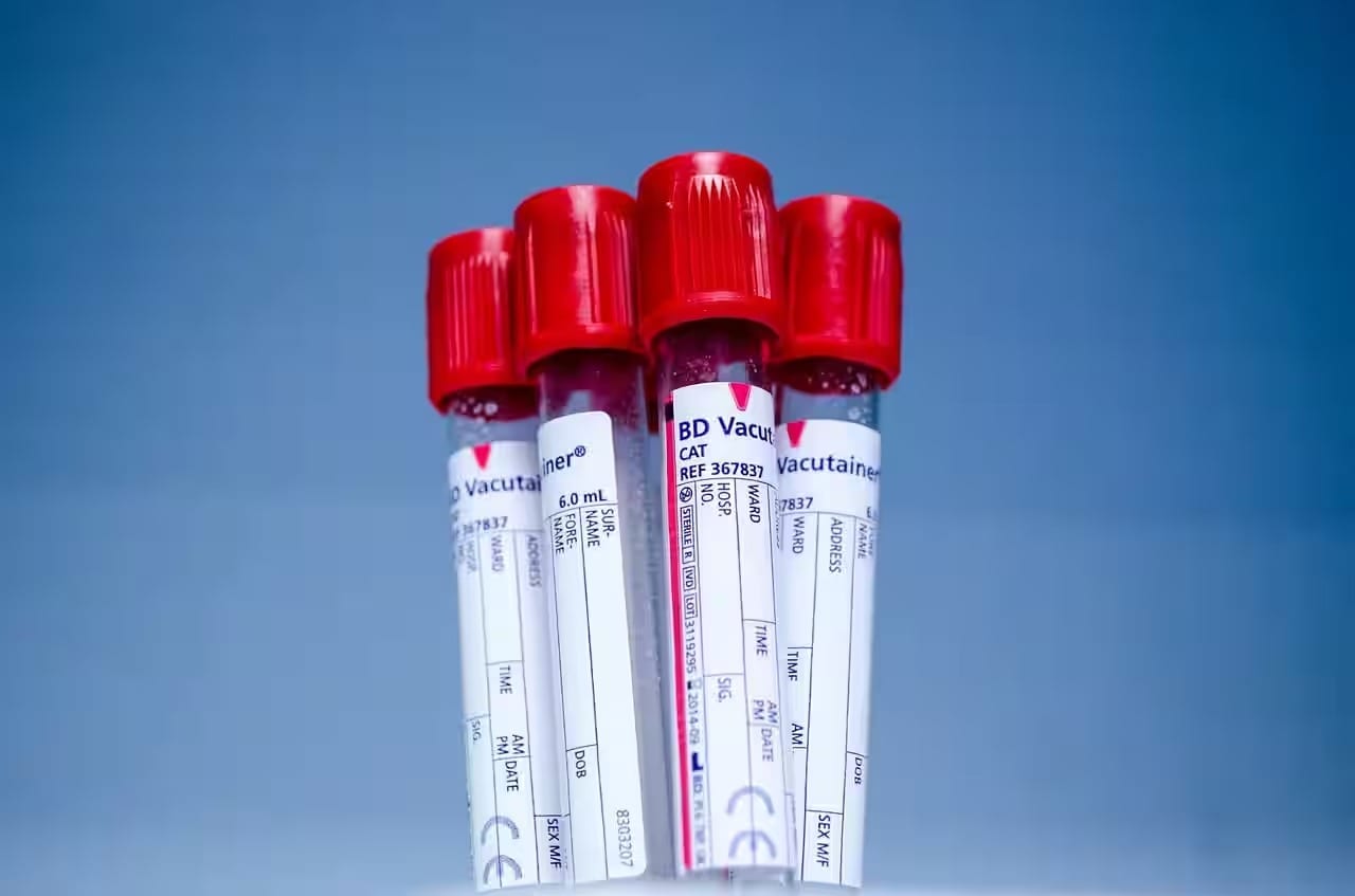 Sickle Cell Anemia Awareness Day: Why Fighting Stigma Is As Important ...