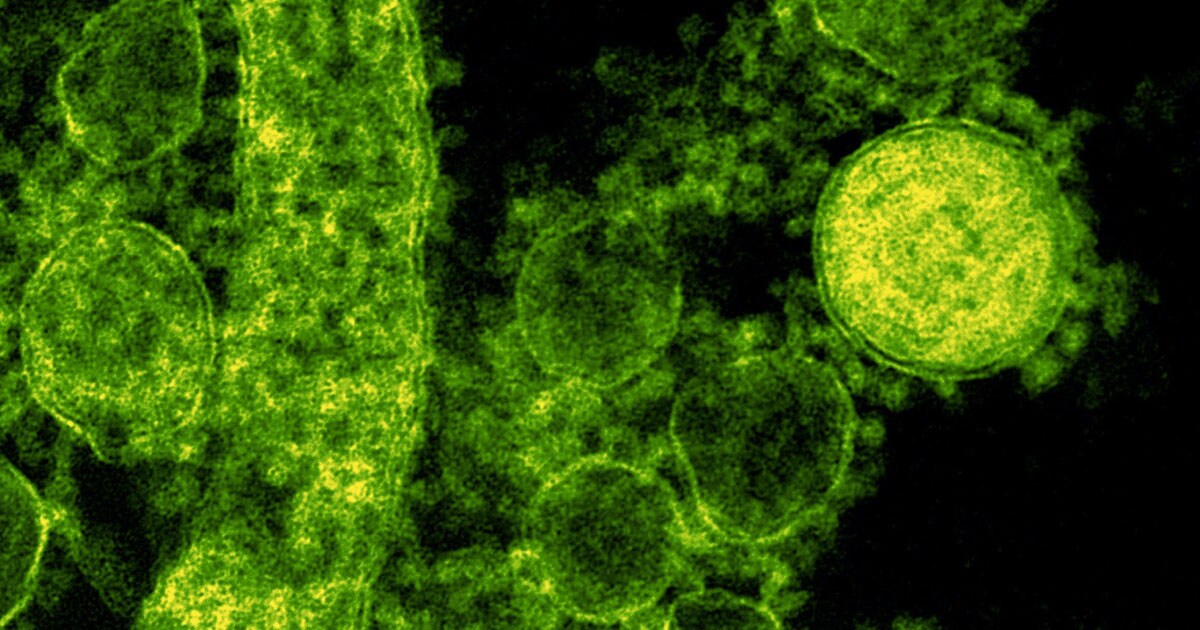Mysterious Virus-Like Life Form Found In Humans