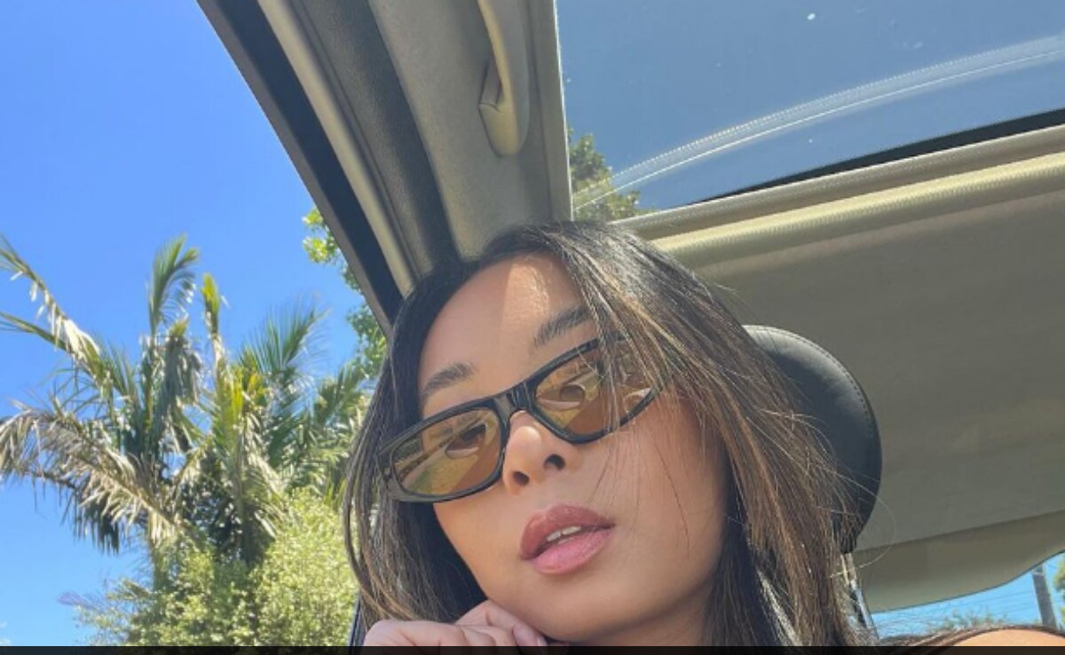 ''So Shocked'': Sydney Influencer Shares How A Full Body Checkup Led To Skin Cancer Discovery