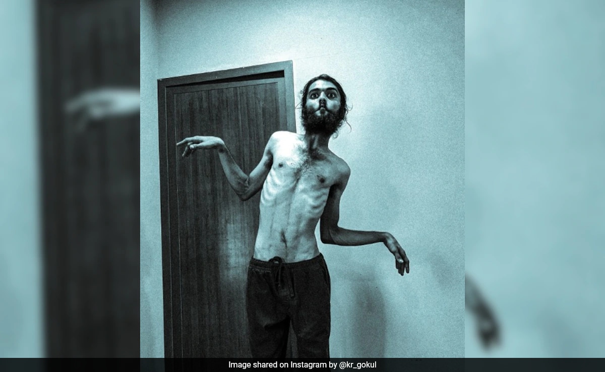 'Aadujeevitham' Actor KR Gokul Shares Pic Of His Extreme Physical ...