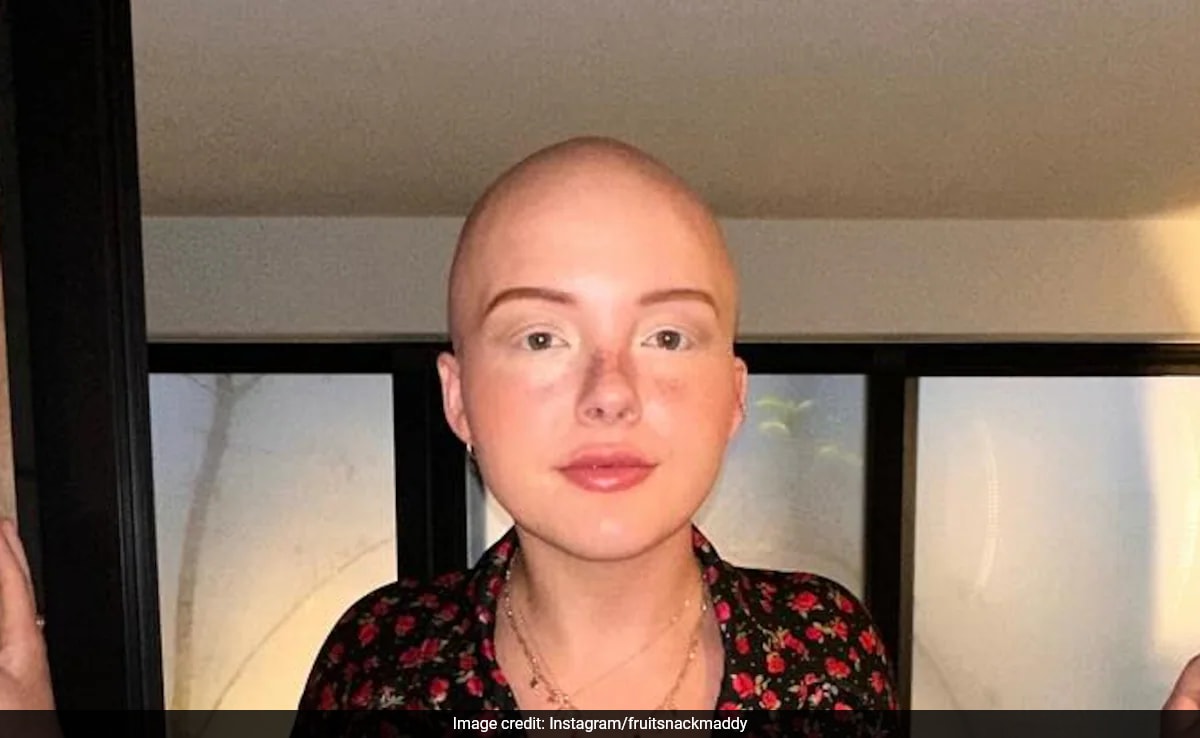 TikTok Star Maddy Baloy, Battling Cancer, Dies At 26