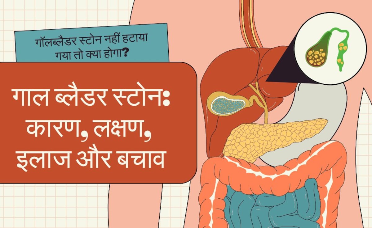 क्या होगा अगर आप नहीं कराएंगे Gallstones का इलाज, जानें पित्त की पथरी ...