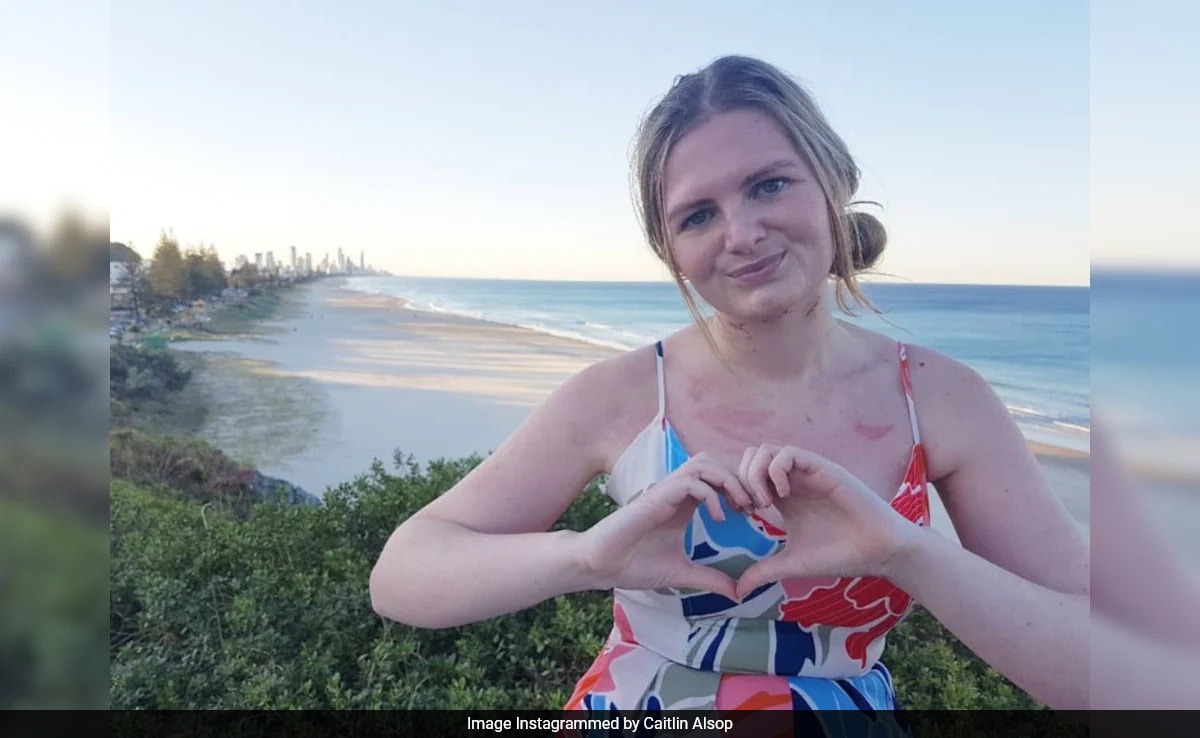 "Medical Mystery": Woman's Infected Wisdom Tooth Leads To Sepsis ...