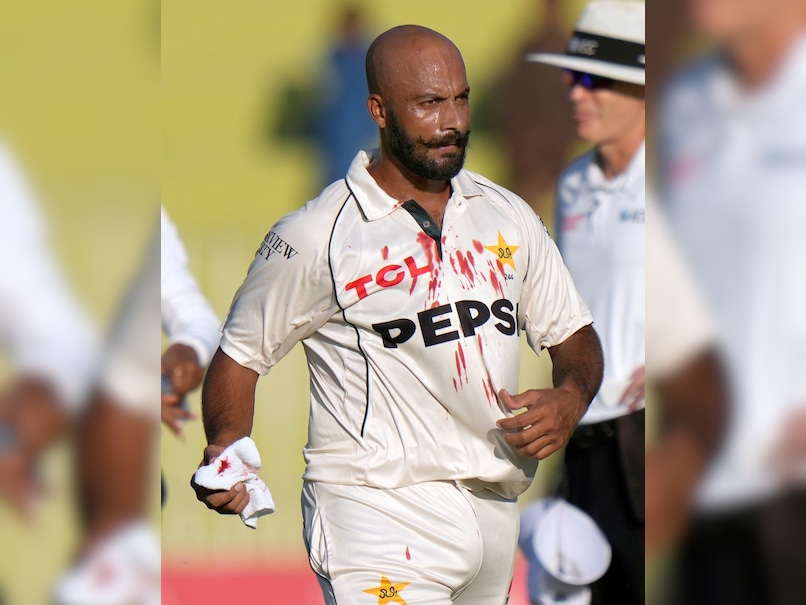 Pakistan Star Sajid Khan Left Bloodied After Ball Hits Face, Goes On To Hit Four Sixes. Image ...