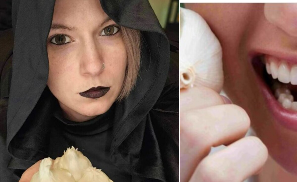 ड्रैकुला जैसे Vampire रोग से गुजर रही महिला, बेहद दर्दनाक है स्थिति ...