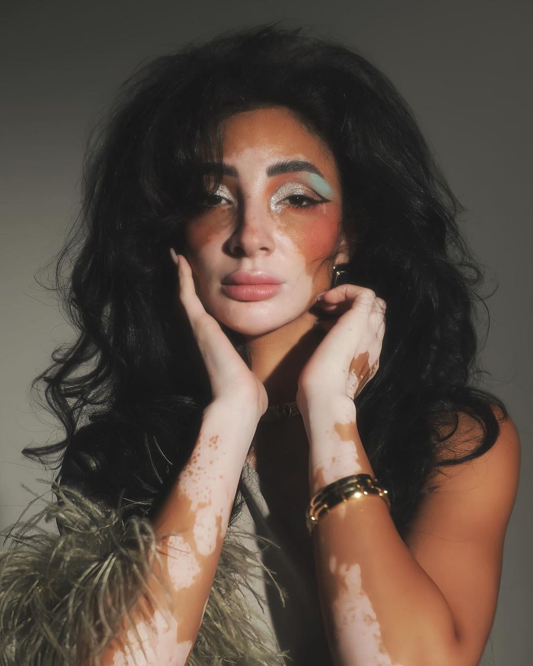 Miss Egypt's Historic Miss Universe Moment With Vitiligo