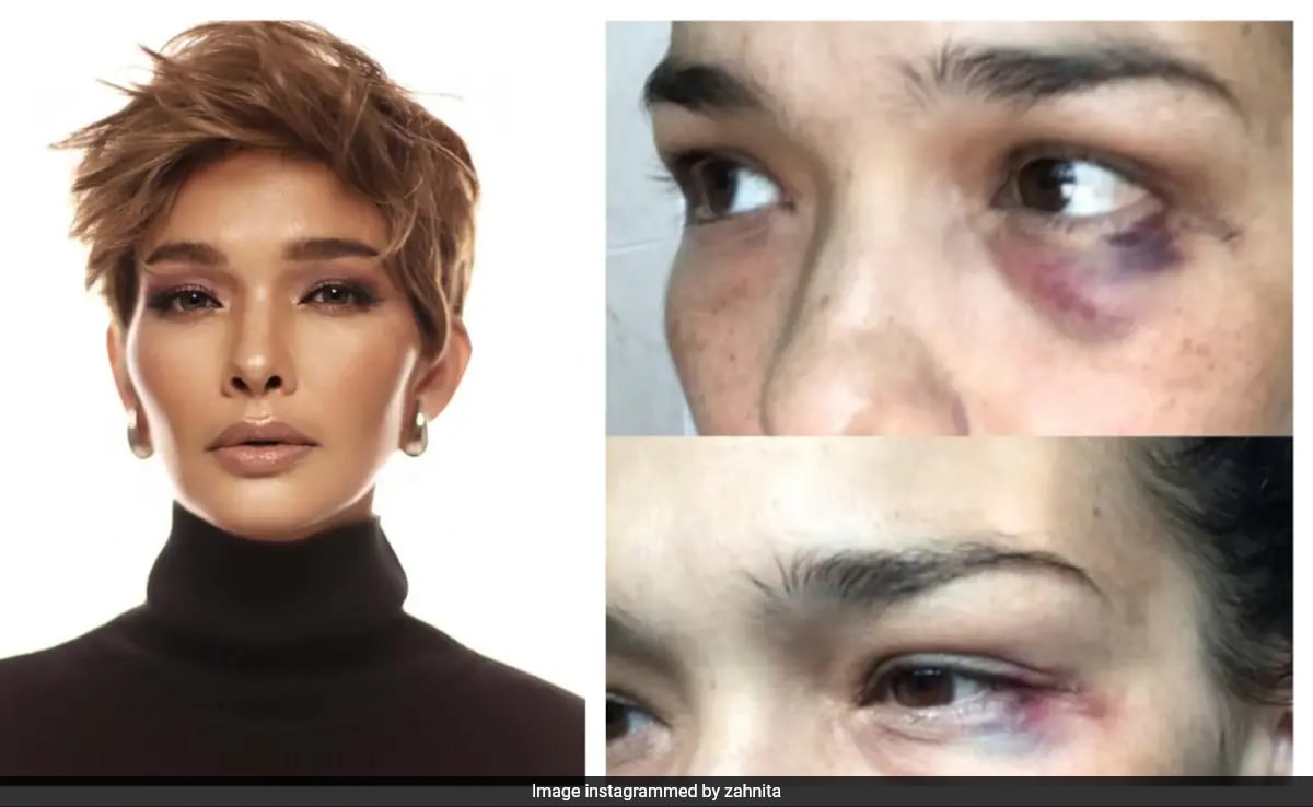 Malaysian Actor Alleges 2 Decades Of Domestic Abuse By Husband, Pics ...