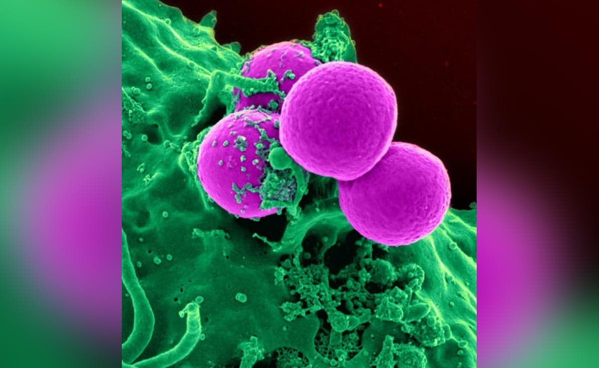 deinococcus radiodurans bacteria