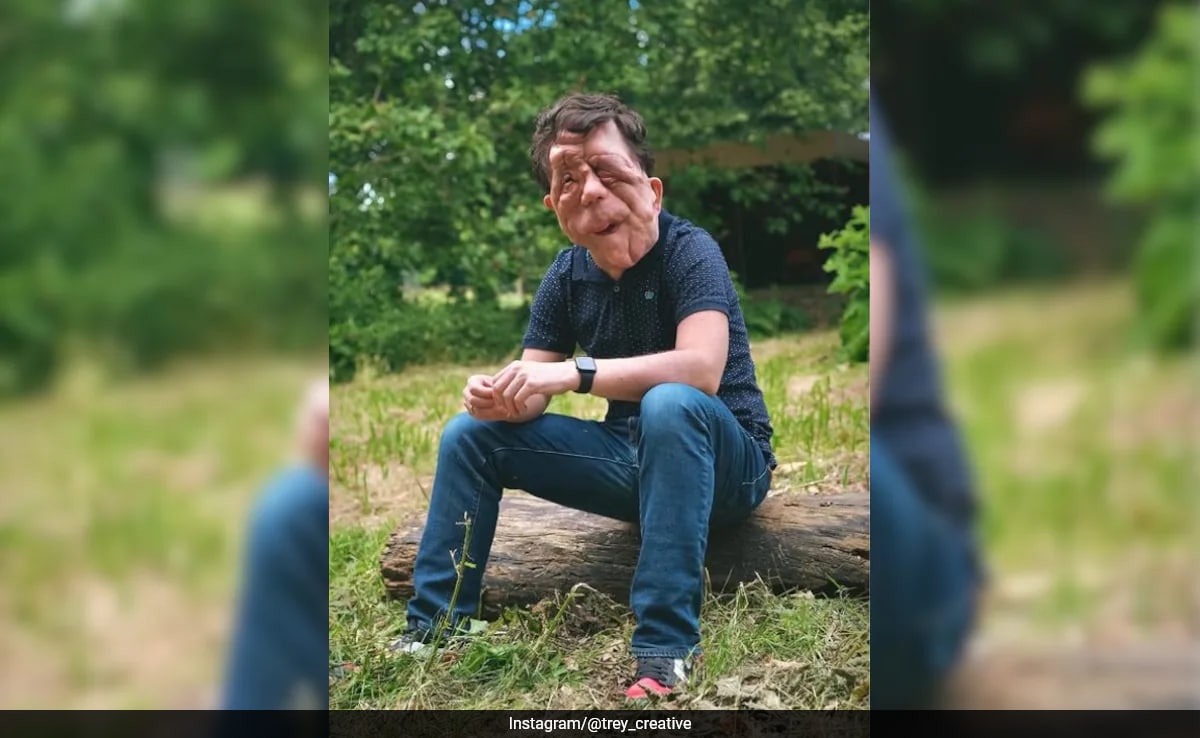 Actor Adam Pearson On Developing Confidence: "Why Feel Normal When You ...