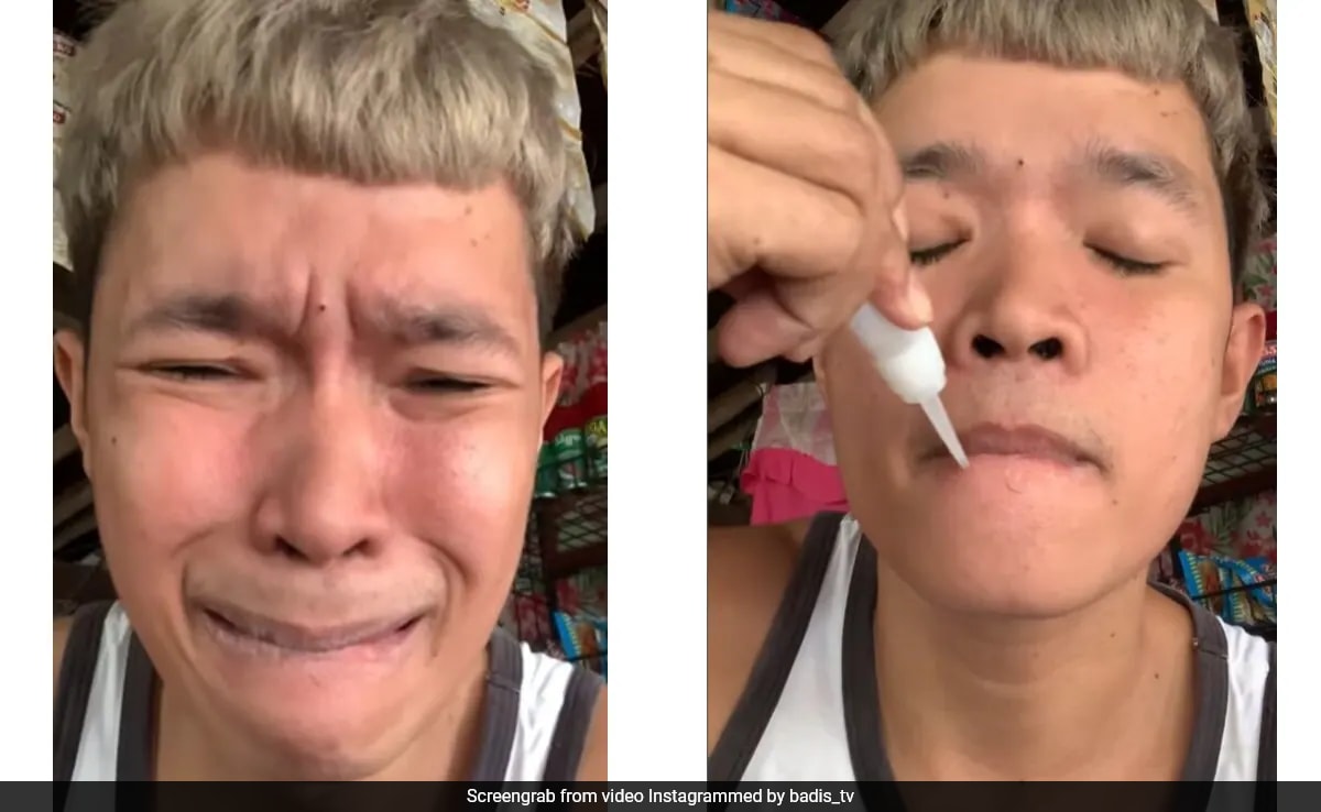 Watch: Man's Superglue Prank Goes Wrong, Seals His Lips Shut. Internet ...