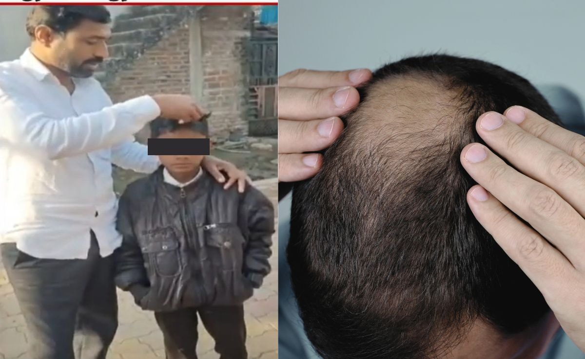 Buldhana Hair Loss Virus Shampoo Water or Air What are the reasons ...