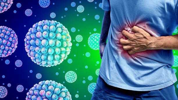 Norovirus Cases Surge In US: Symptoms, Causes, And Treatment