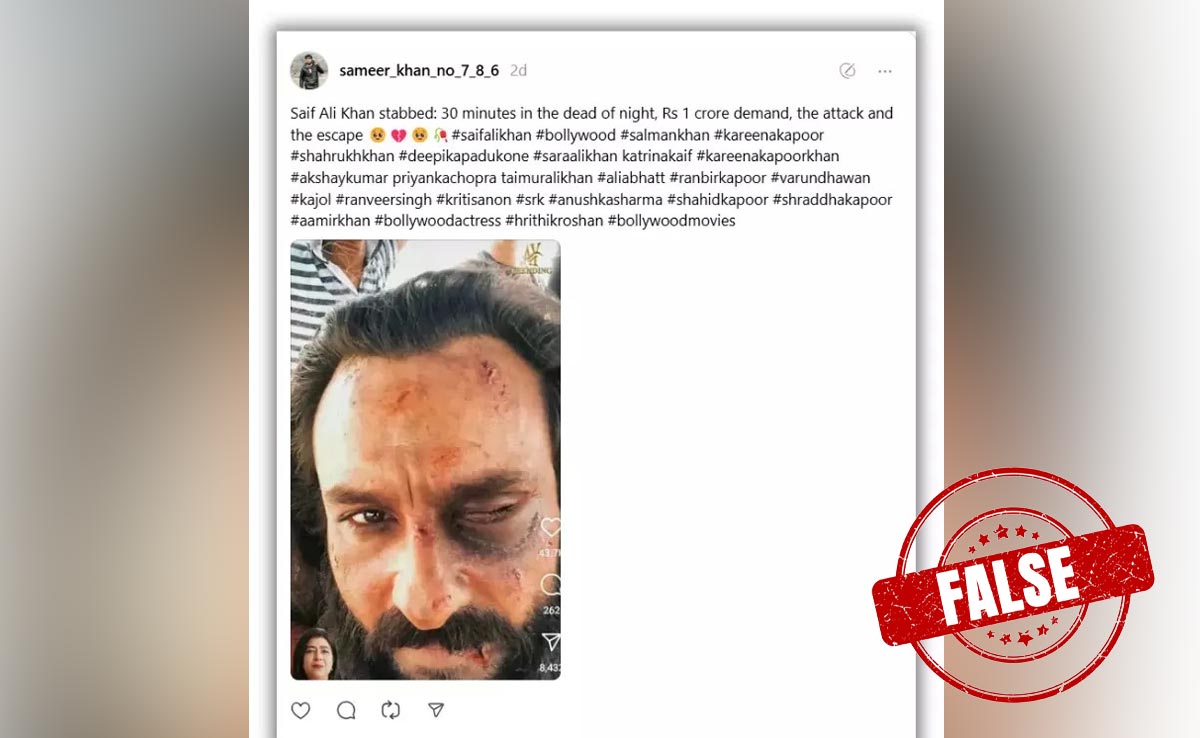Fact Check: Saif Ali Khan's Face, Eye Injured During Knife Attack?