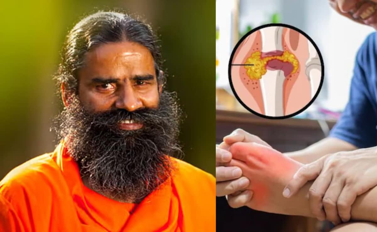 Swami Ramdev ने बताया जड़ से खत्म हो जाएगा Uric Acid, बस पी लें इस जड़ी-बूटी का पानी, प्यूरीन के ...