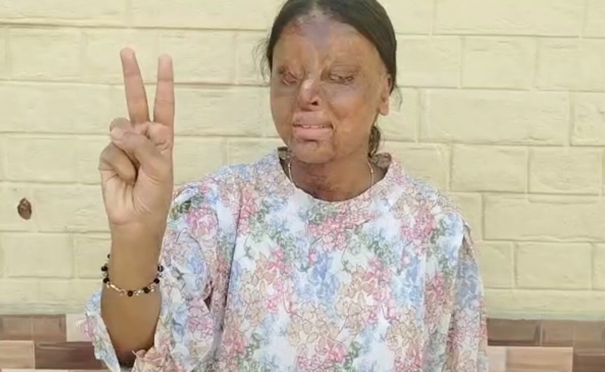 acid-attack-survivor-kafi-scores-95-6-in-class-12-board-exam-inspiring ...