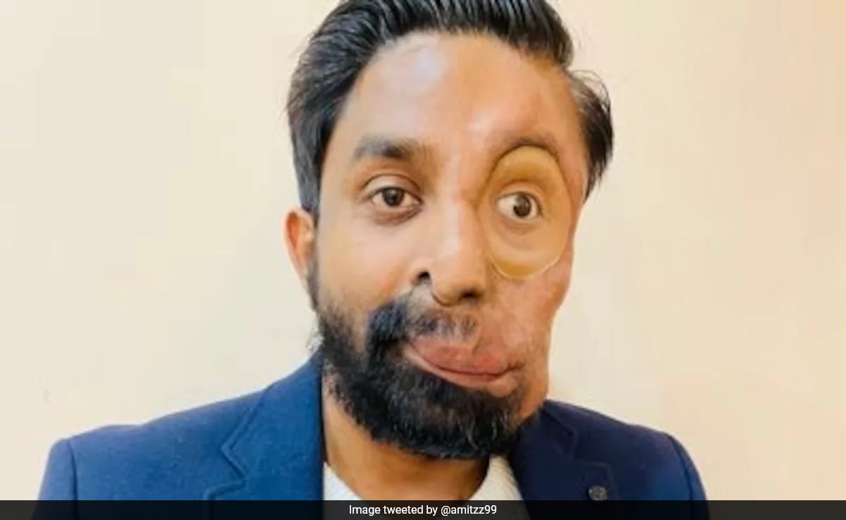 Indian-Origin Man Claims London Cafe Refused Him Service Because Of His ...