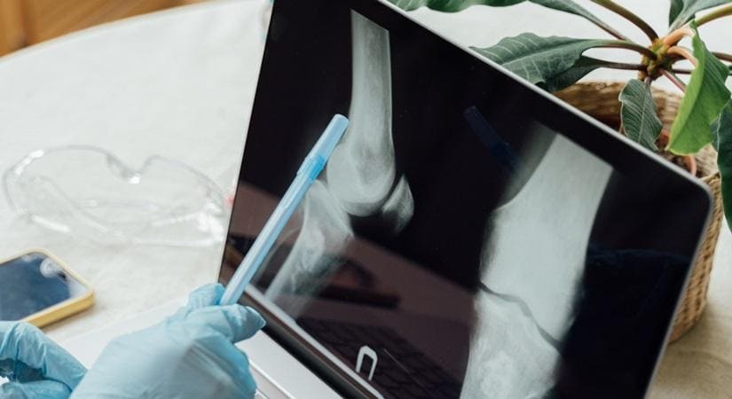 Rare Bone Cancer: Teen Recovers After Ventilator Support In Delhi