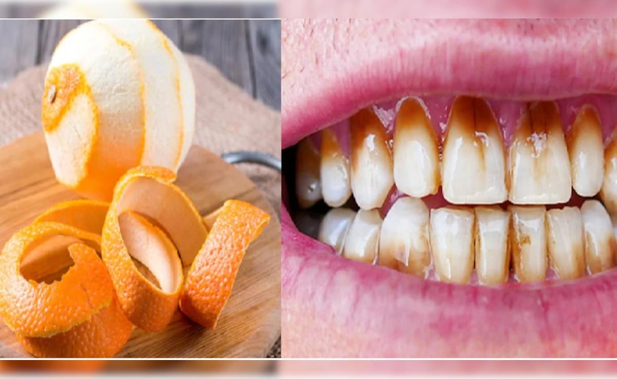 दांतों के पीलेपन को साफ करने के लिए इस फल का छिलका कारगर, दांत दूध की ...