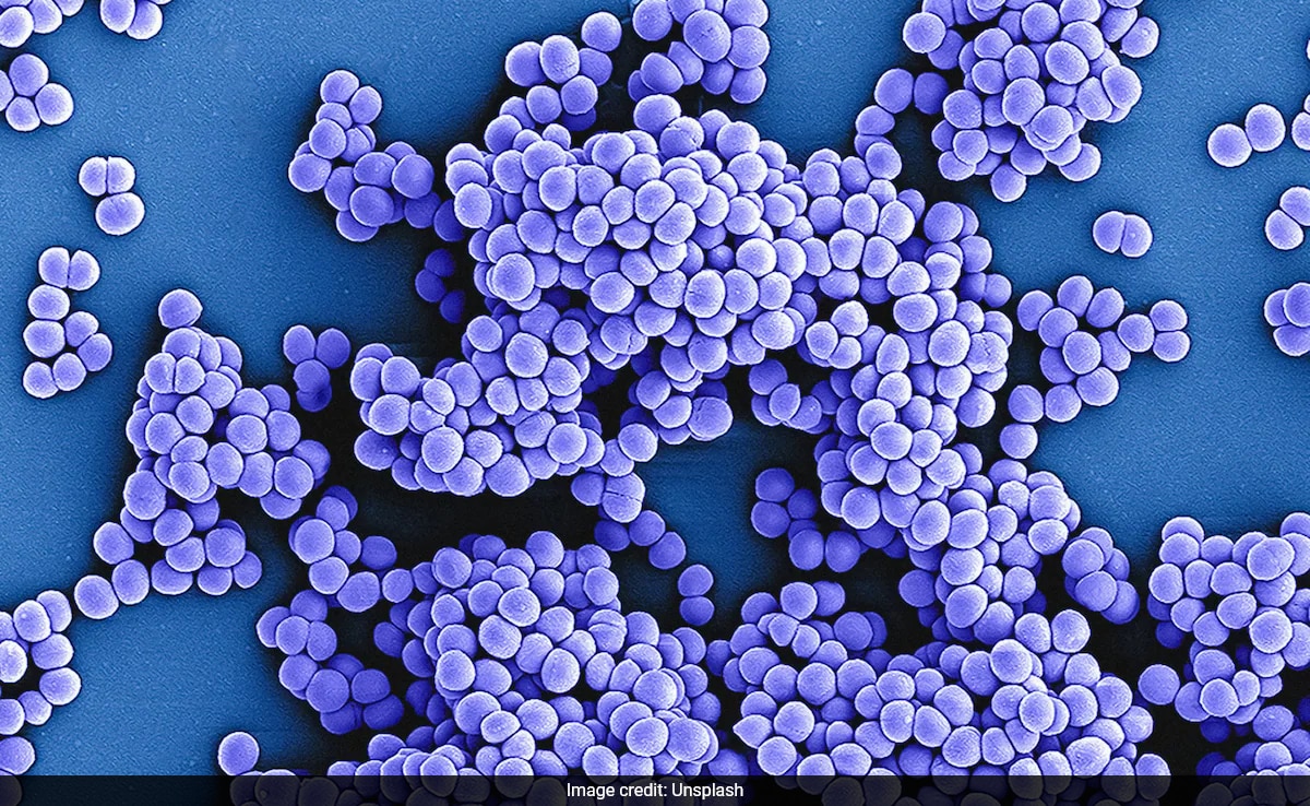 Fitness Enthusiasts Warned in US, UK After Rise In Superbug Infections