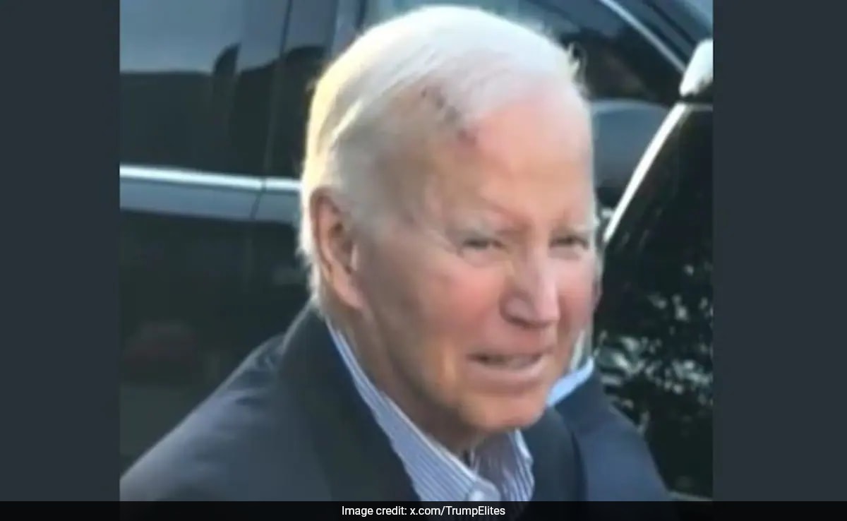 Joe Biden Undergoes Skin Cancer Surgery, Seen With Huge Wound On Head