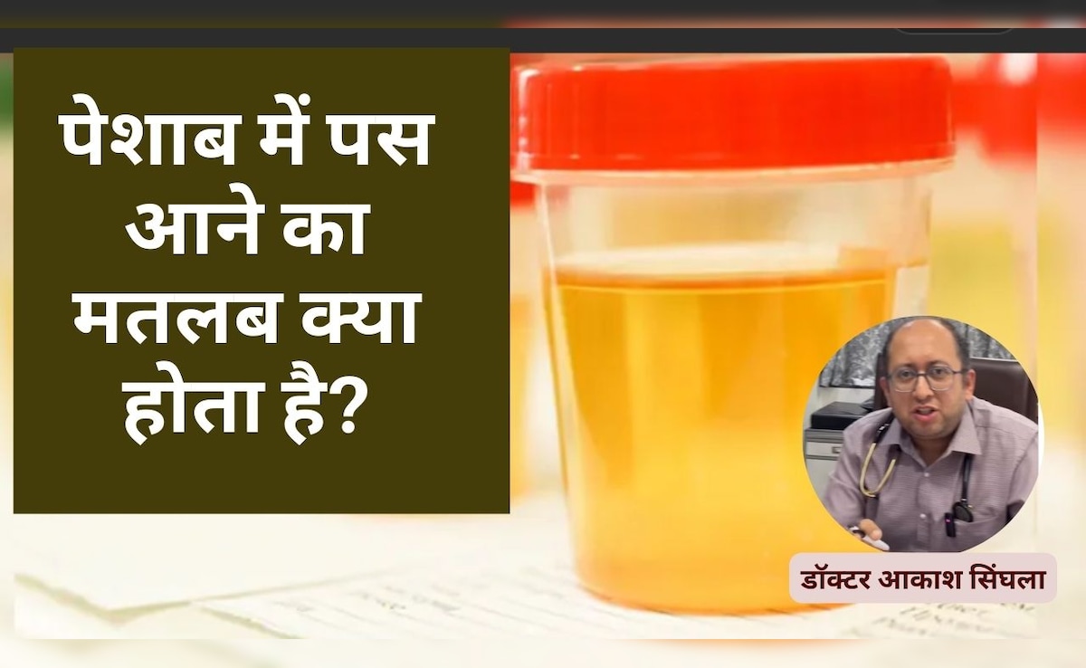 पेशाब में पस आने का क्या कारण है? Doctor ने बताया पेशाब में पस आने का ...