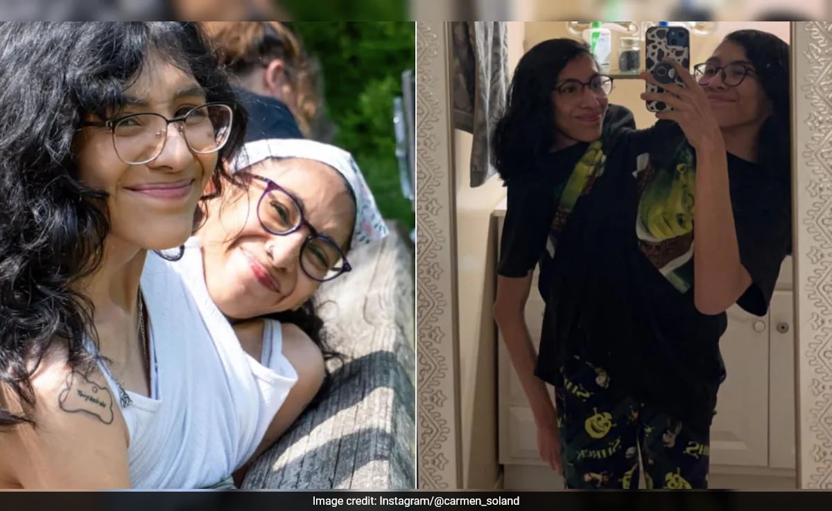 Conjoined Twins Open Up About Love, Life And Intimacy After One Sister ...