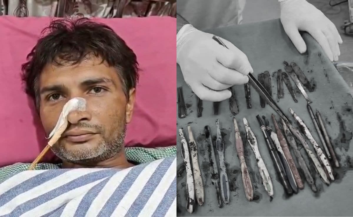 Family Sent UP Man To Rehab. He Got Addicted To Eating Spoons, Toothbrushes