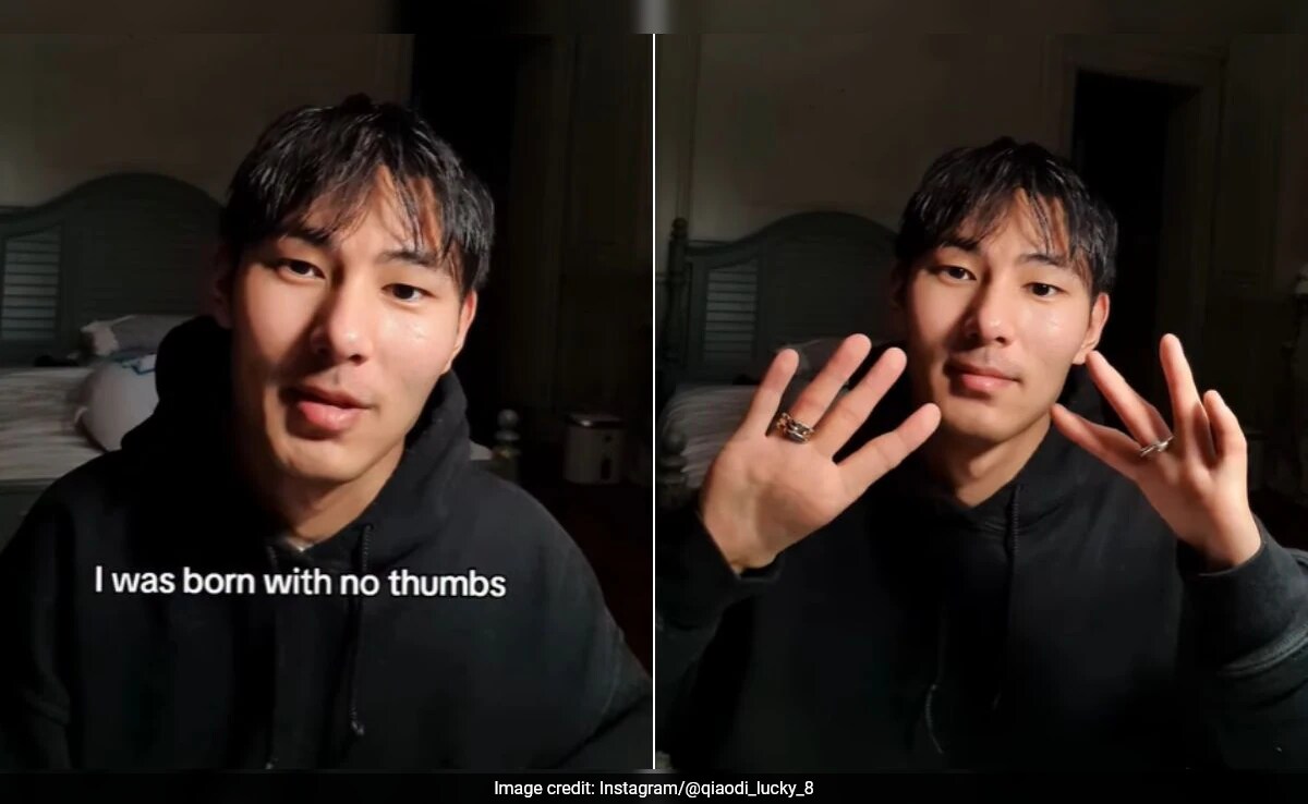 Video: Chinese Man, Born Without Thumbs, Goes Viral For Creativity And ...