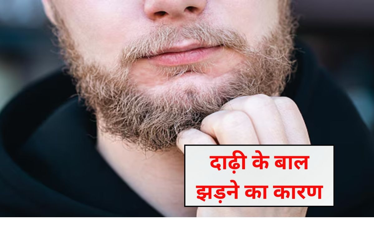 मैं अपनी दाढ़ी के बालों को झड़ने से कैसे रोकूं? दाढ़ी के बालों को घना ...