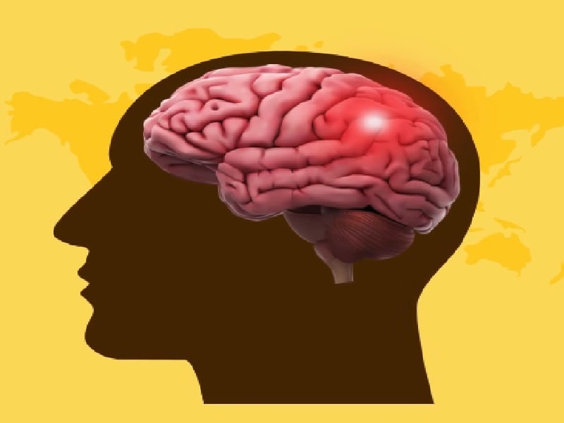 Mini-Stroke Symptoms: 7 Signs Of Transient Ischemic Attack That You ...