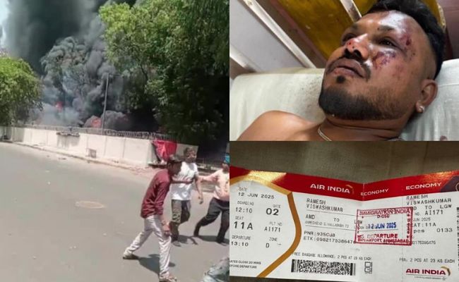 Every Day Is Painful: Lone Air India Crash Survivor After Miracle Escape