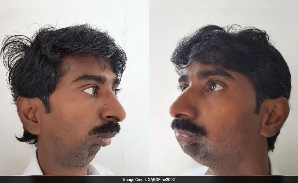 Who Is Rajendra Panchal? Pune Man Whose Viral Pic Is Used In Racist ...