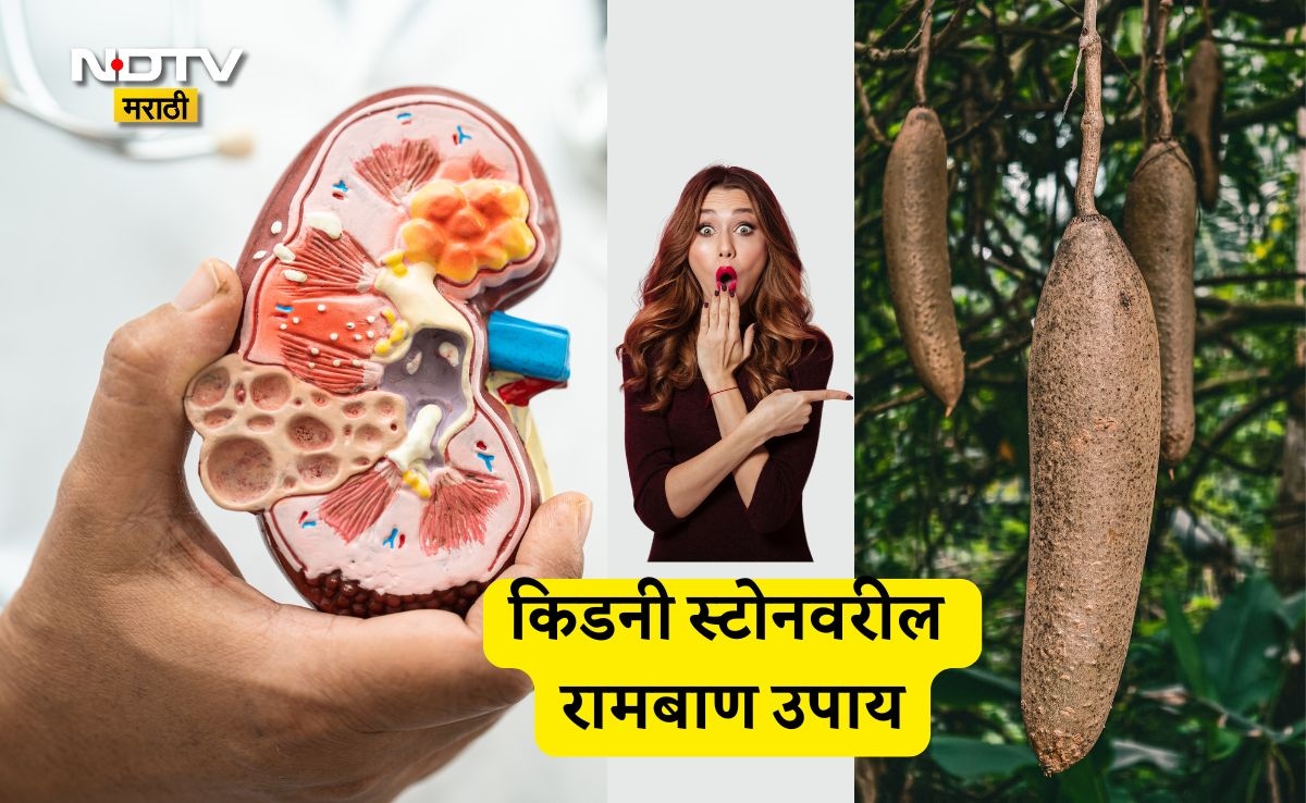 Health News Kidney Stones Treatment Sausage Tree Fruit Kadha Benefits ...