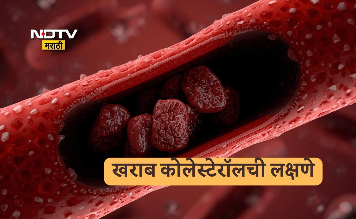 Health News Bad cholesterol Symptoms LDL Symptoms High Cholesterol ...