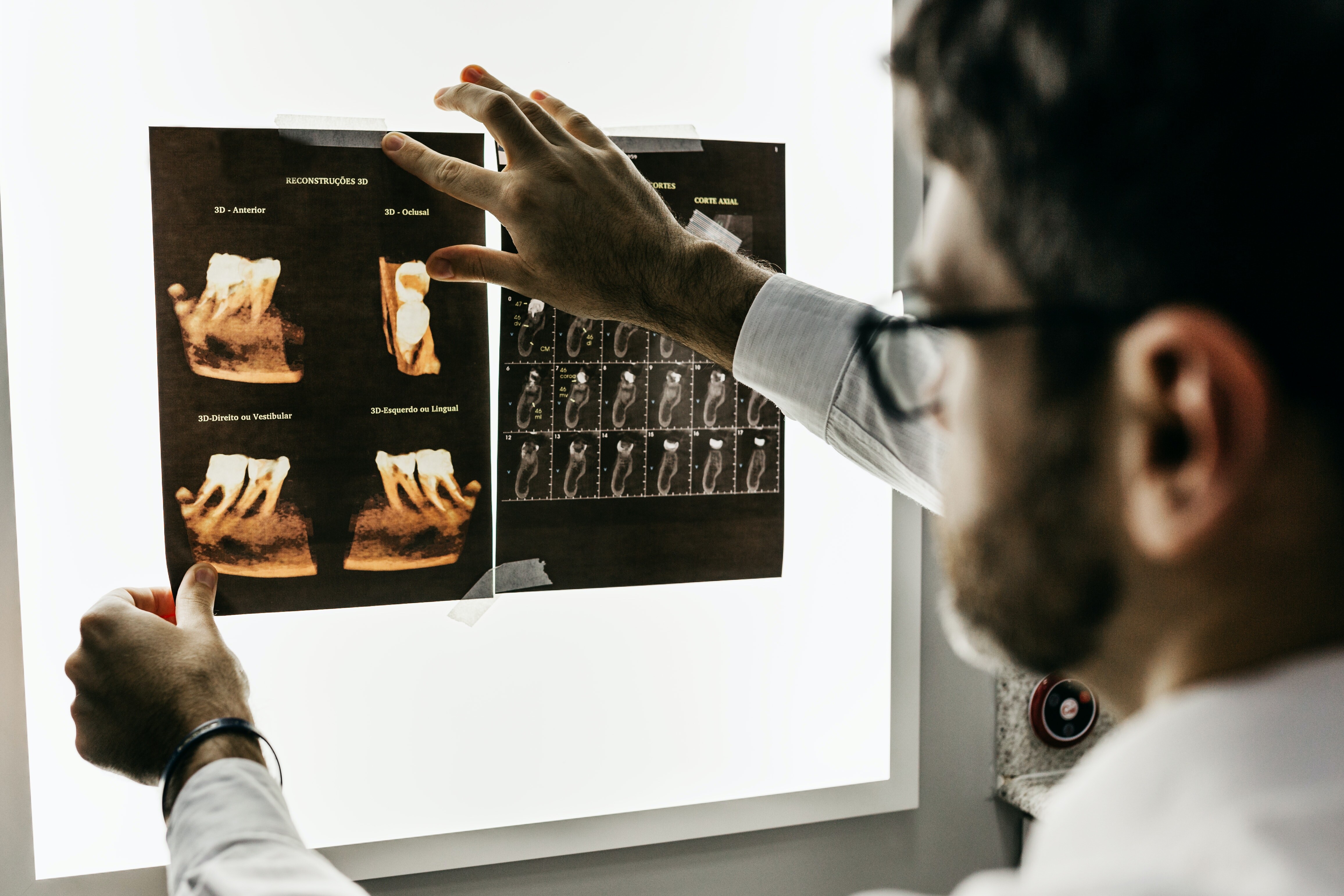 Government Hikes Duty On X-ray Machine Imports To 15% From April 1