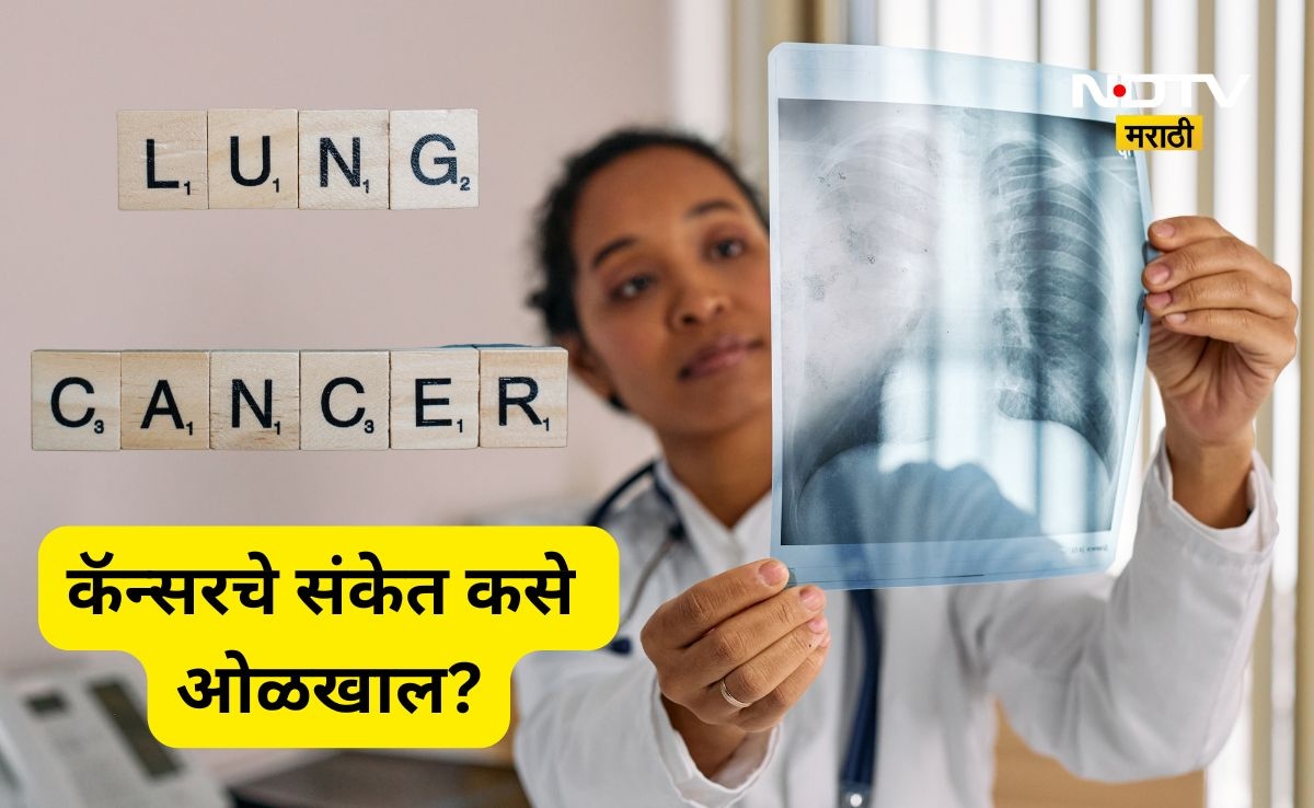 Lung Cancer Signs hidden signs of lung cancer finger clubbing and leg ...