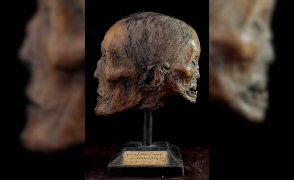 इतिहास का सबसे दुर्लभ केस, एक-दूसरे के दुश्मन बने इंसान के 2 चेहरे ...