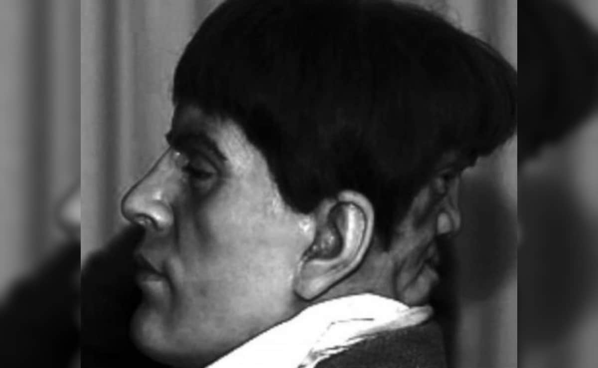 इतिहास का सबसे दुर्लभ केस, एक-दूसरे के दुश्मन बने इंसान के 2 चेहरे ...