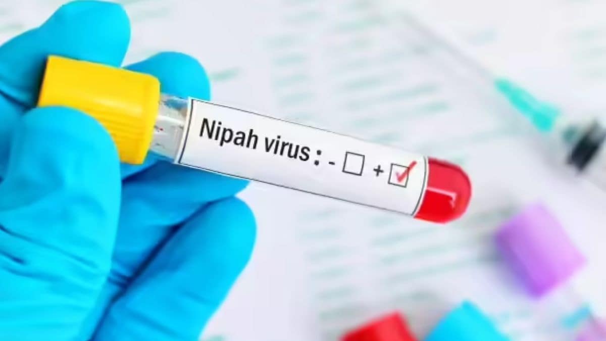 Kerala Issues Nipah Virus Alert From April To September 2026 Based On ...