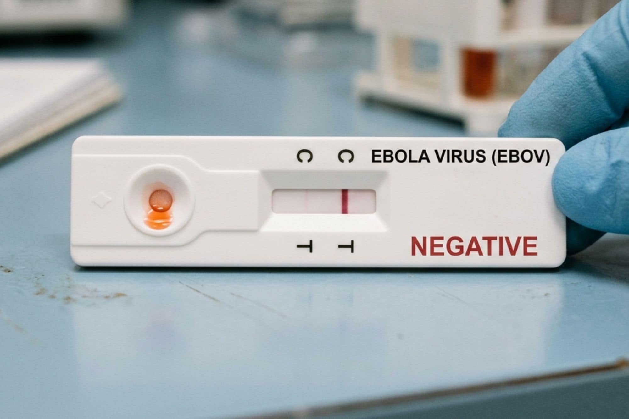 1 Of 2 Patients With Ebola-Like Symptoms Tests Negative In Brazil