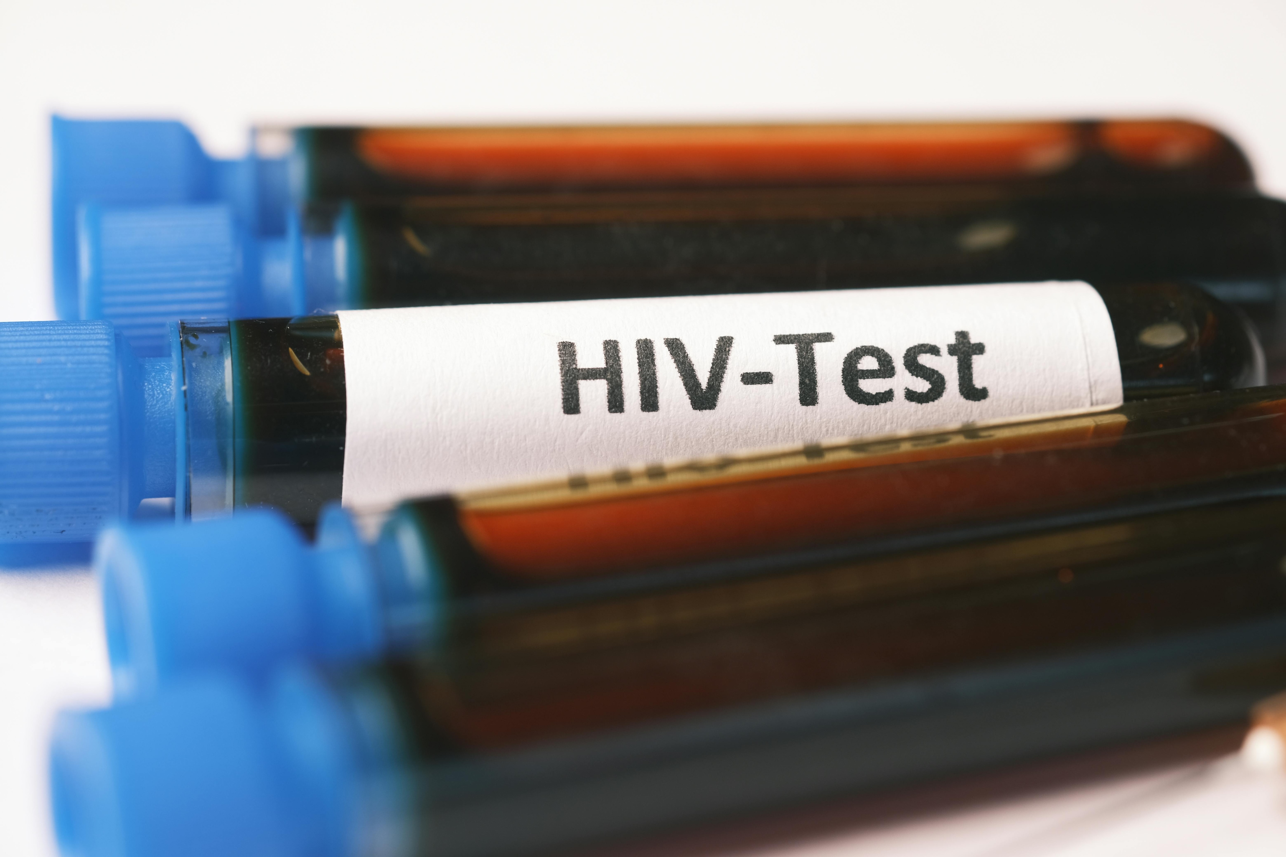 HIV Enters The Brain And Doesn't Leave - Paradoxically, Drugs Intended ...
